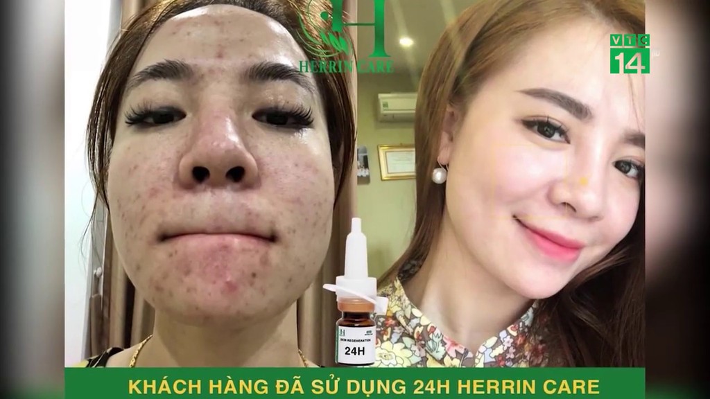 Herrin Care Mỹ Phẩm, Cửa hàng trực tuyến | Shopee Việt Nam