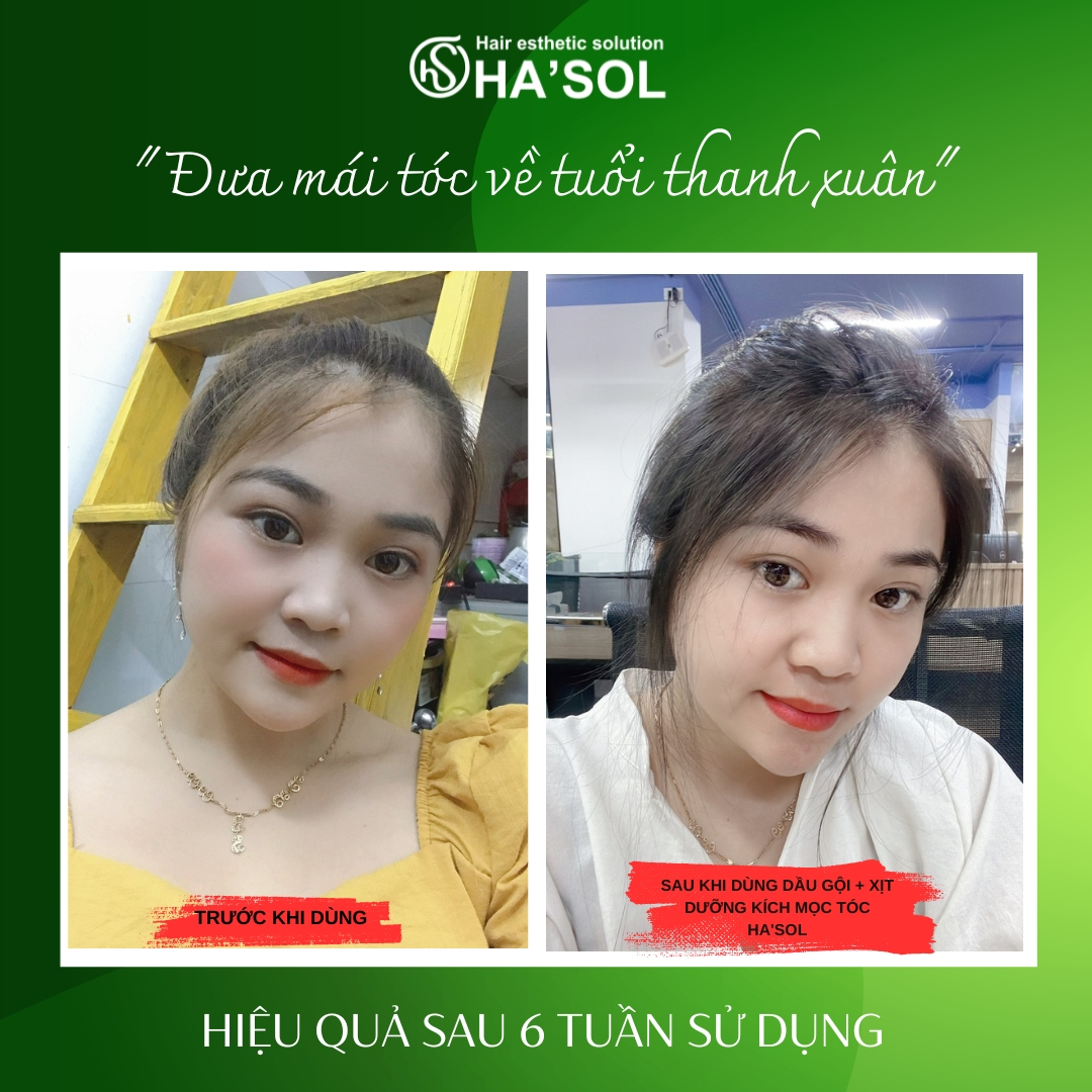 HA'SOL VIỆT NAM, Cửa hàng trực tuyến | Shopee Việt Nam