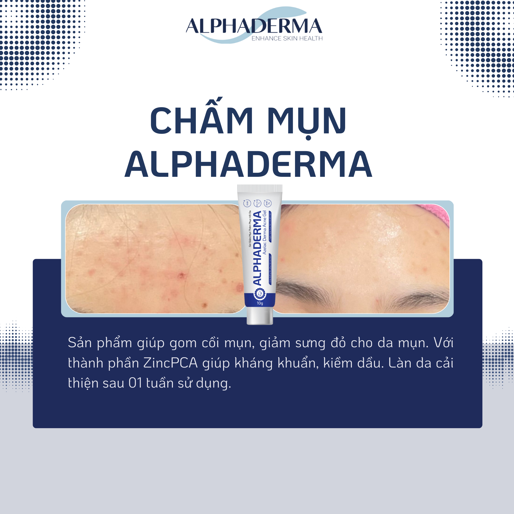 Alphaderma Official Store - Shopee Mall Online | Shopee Việt Nam